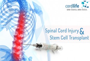 Spinal Cord Injury and Stem Cell Transplant