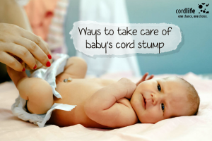 How to Care Your Baby’s Cord Stump?