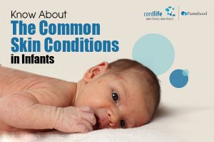 Know About the Common Skin Conditions in Infants - Cordlife India
