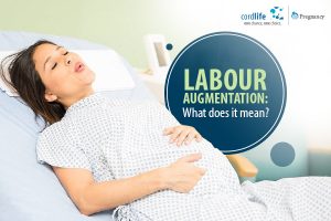 Labour Augmentation: What Does It Mean? - Cordlife India
