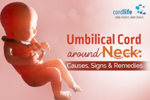 Why Does The Baby Wrap The Umbilical Cord Around The Neck?